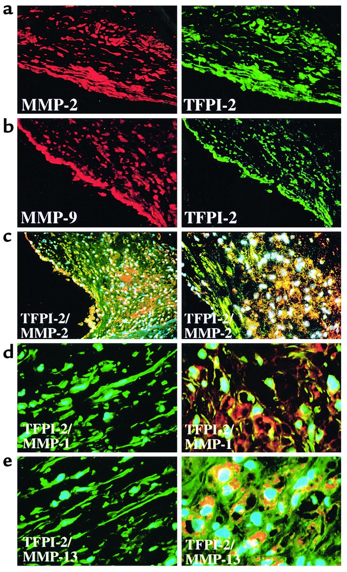 JCI - Tissue factor pathway inhibitor-2 is a novel inhibitor of matrix ...