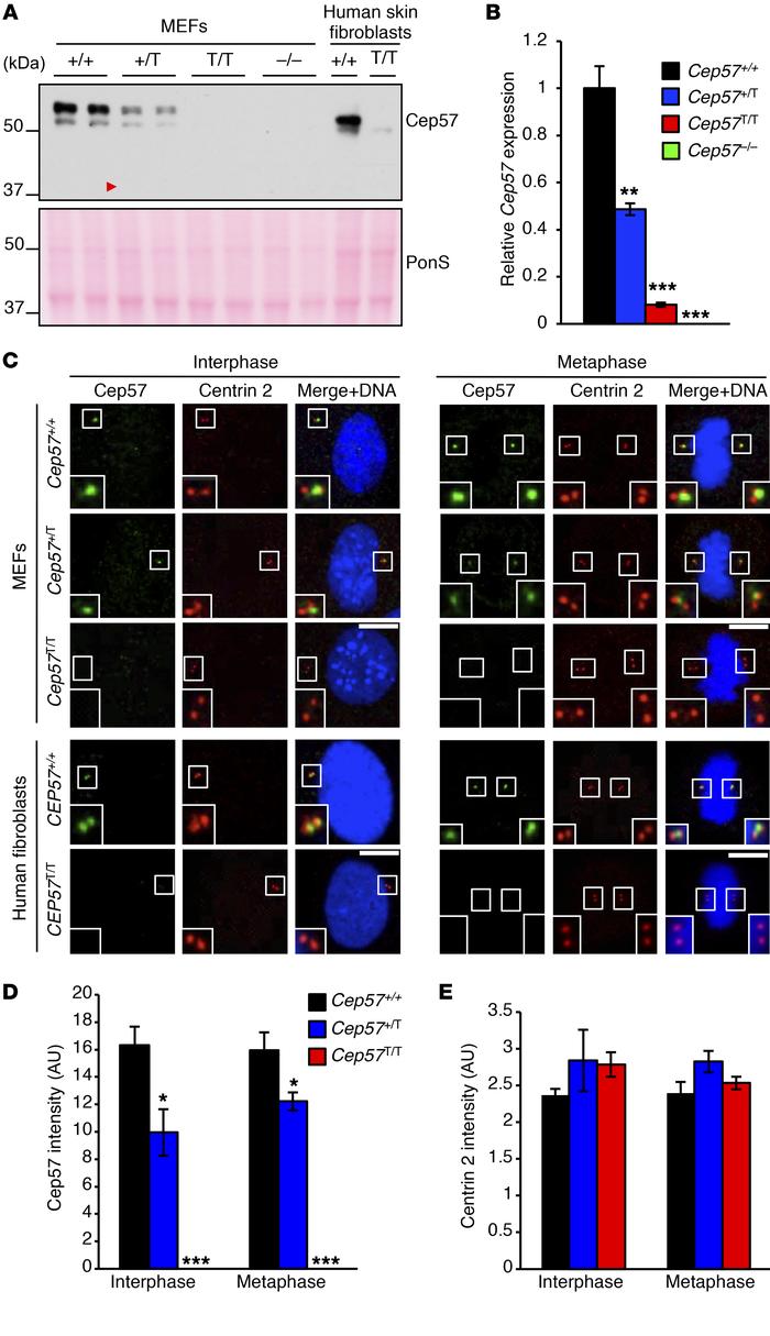 JCI - Mosaic-variegated aneuploidy syndrome mutation or ...