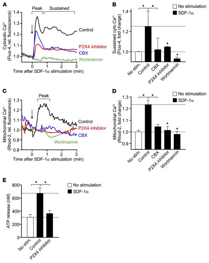 JCI - Purinergic P2X4 receptors and mitochondrial ATP production ...