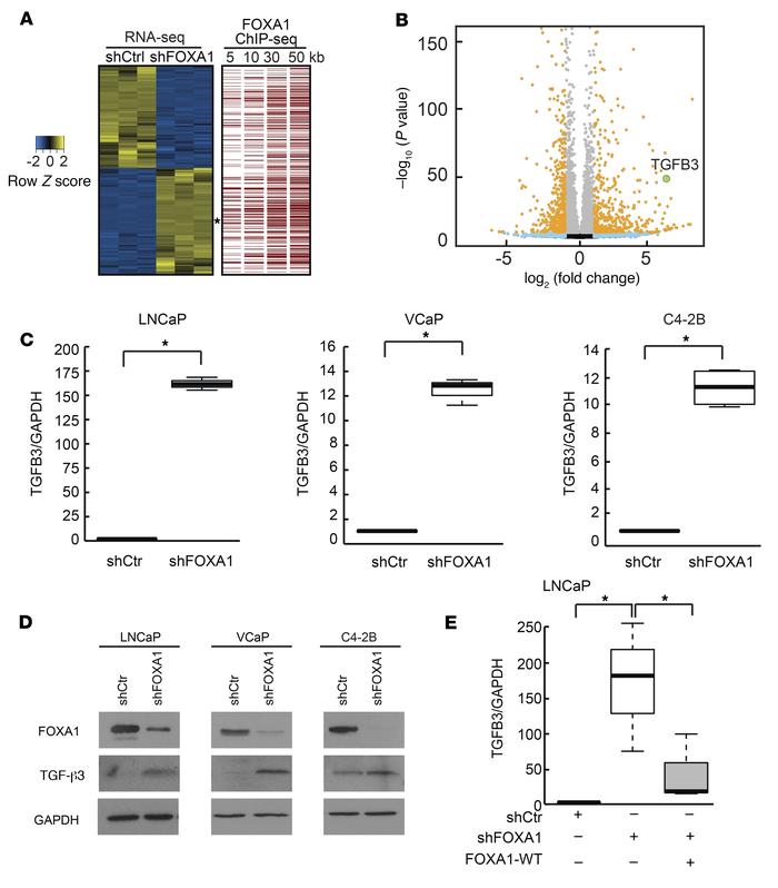 JCI - Targeting FOXA1-mediated repression of TGF-β signaling suppresses ...