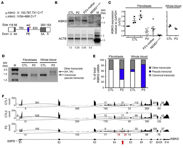 JCI - Rescue of recurrent deep intronic mutation underlying cell type ...