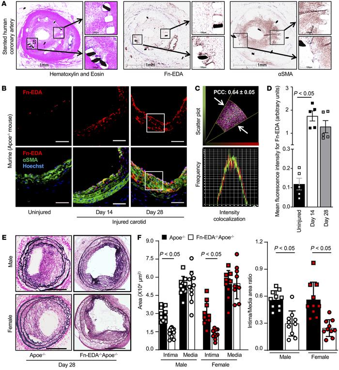 JCI - Smooth muscle cell–specific fibronectin-EDA mediates phenotypic ...