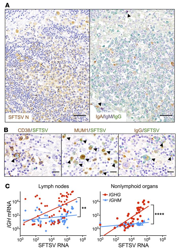 JCI - Severe fever with thrombocytopenia syndrome virus targets B cells ...