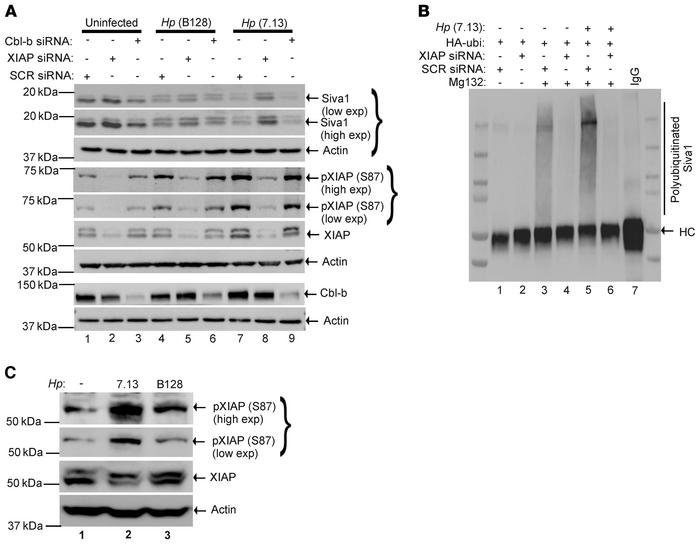 JCI - Bacterial CagA protein compromises tumor suppressor mechanisms in ...