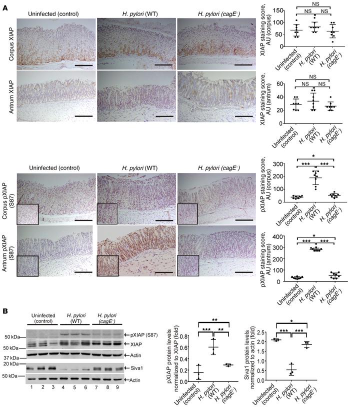 JCI - Bacterial CagA protein compromises tumor suppressor mechanisms in ...