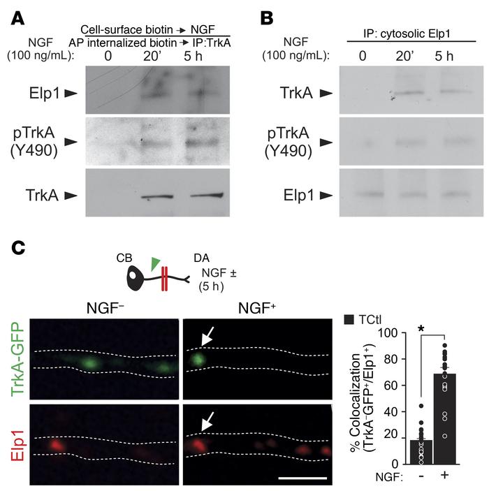 JCI - Retrograde nerve growth factor signaling abnormalities in ...