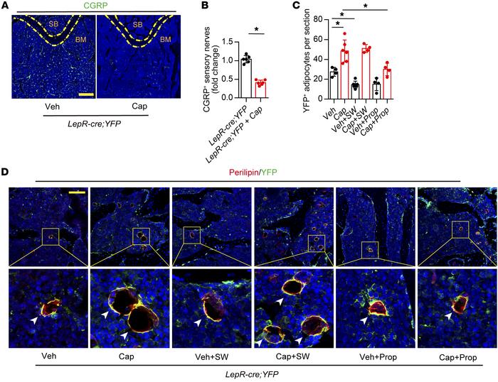 JCI - Sensory nerves regulate mesenchymal stromal cell lineage ...
