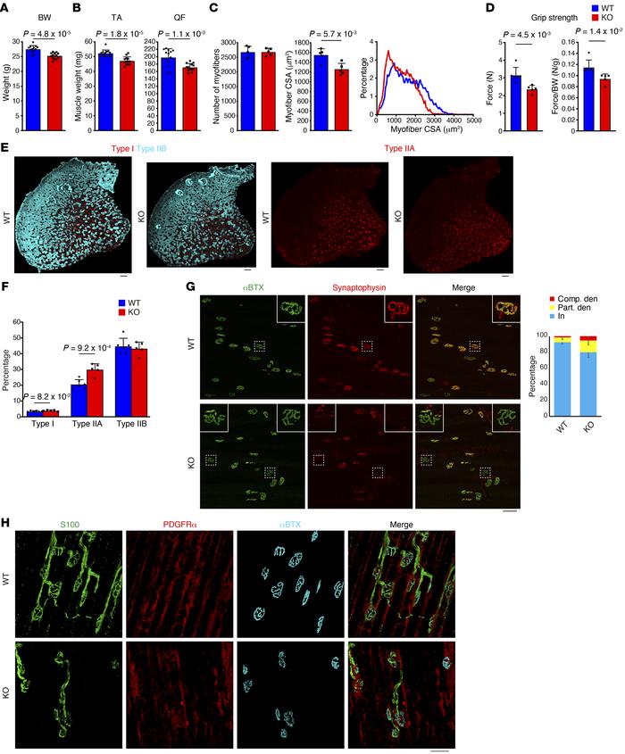 JCI - Mesenchymal Bmp3b expression maintains skeletal muscle integrity ...