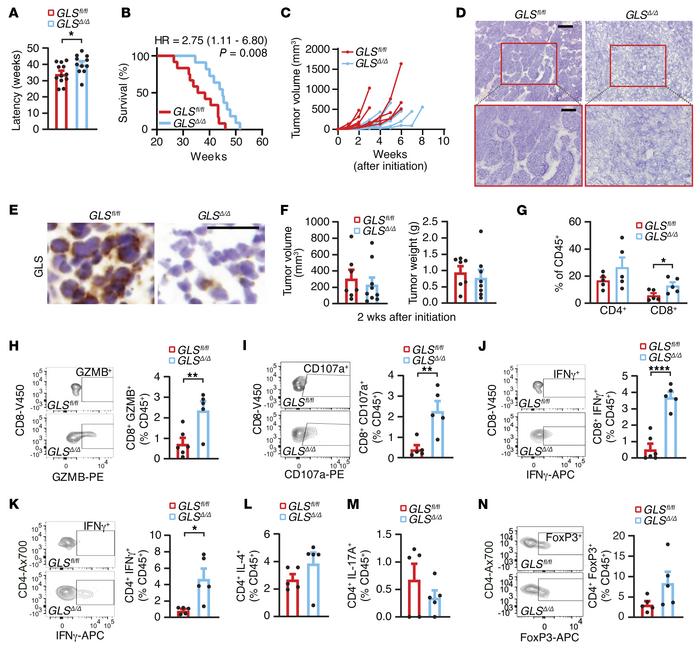 JCI - Selective glutamine metabolism inhibition in tumor cells improves ...