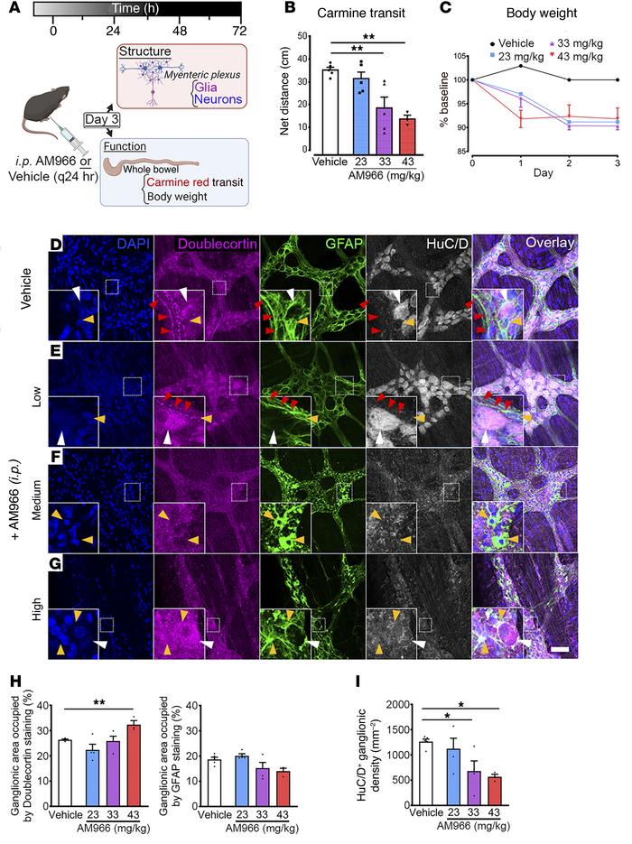 JCI - LPAR1 regulates enteric nervous system function through glial ...