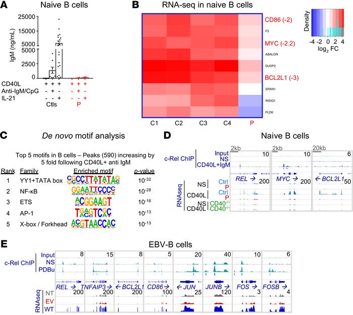 JCI - Inherited human c-Rel deficiency disrupts myeloid and lymphoid ...