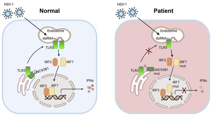 JCI - IRF7 and UNC93B1 variants in an infant with recurrent herpes ...