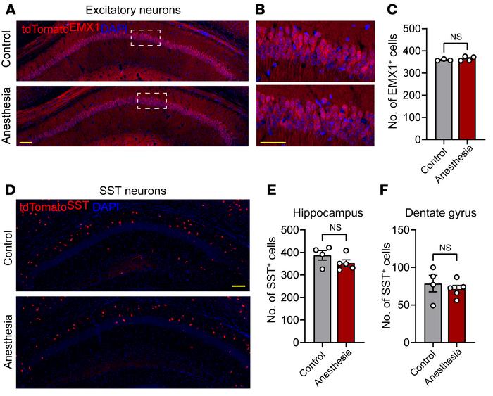 JCI - Parvalbumin interneuron loss mediates repeated anesthesia-induced ...