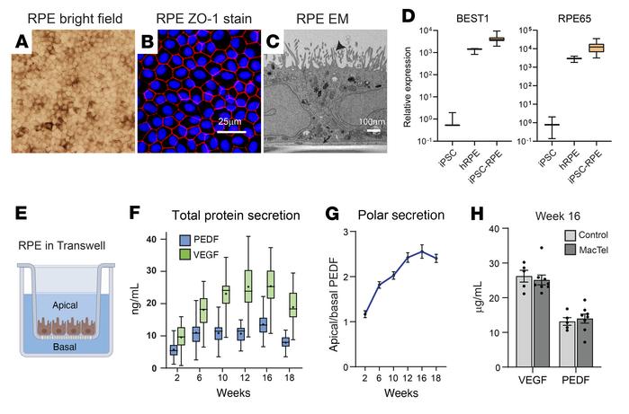 JCI - iPSC–derived retinal pigmented epithelial cells from patients ...