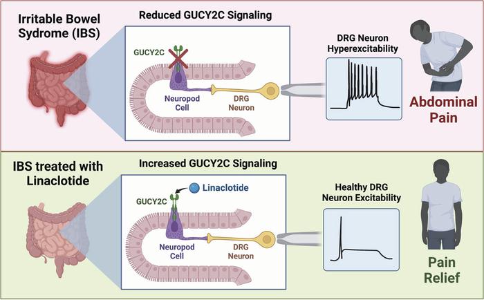 JCI - Intestinal neuropod GUCY2C regulates visceral pain