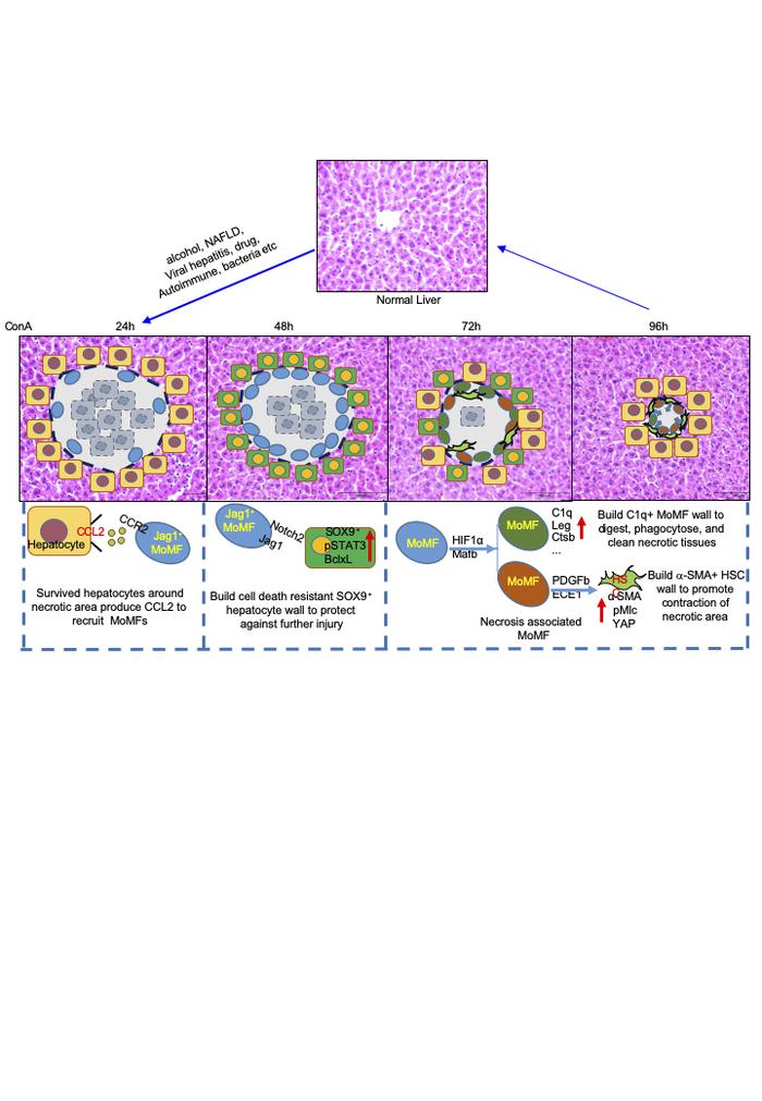 JCI - Monocyte-derived macrophages orchestrate multiple cell-type ...
