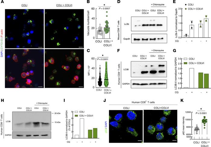 JCI - Oncogene-induced matrix reorganization controls CD8+ T cell ...