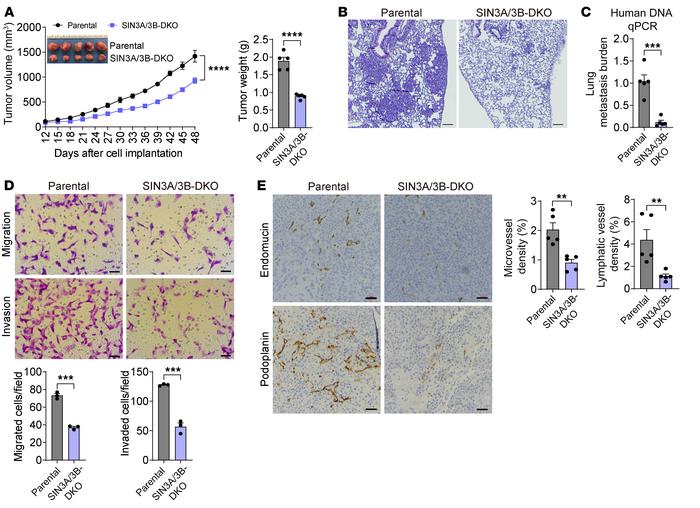 JCI - SAP30 promotes breast tumor progression by bridging the ...