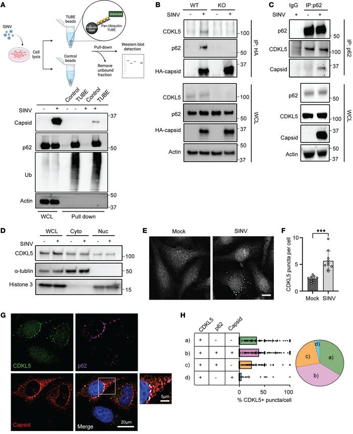 JCI - CDKL5 regulates p62-mediated selective autophagy and confers ...