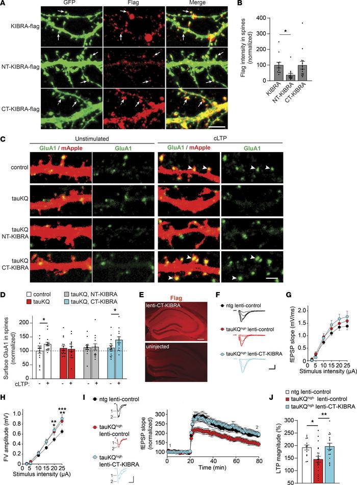 JCI - KIBRA repairs synaptic plasticity and promotes resilience to ...