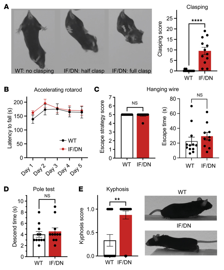 JCI - Mouse model of atypical DAT deficiency syndrome uncovers dopamine ...