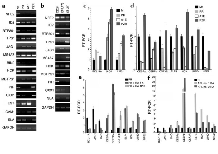 JCI - Acute myeloid leukemia fusion proteins deregulate genes involved ...
