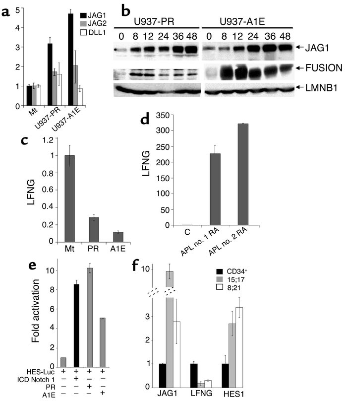JCI - Acute myeloid leukemia fusion proteins deregulate genes involved ...