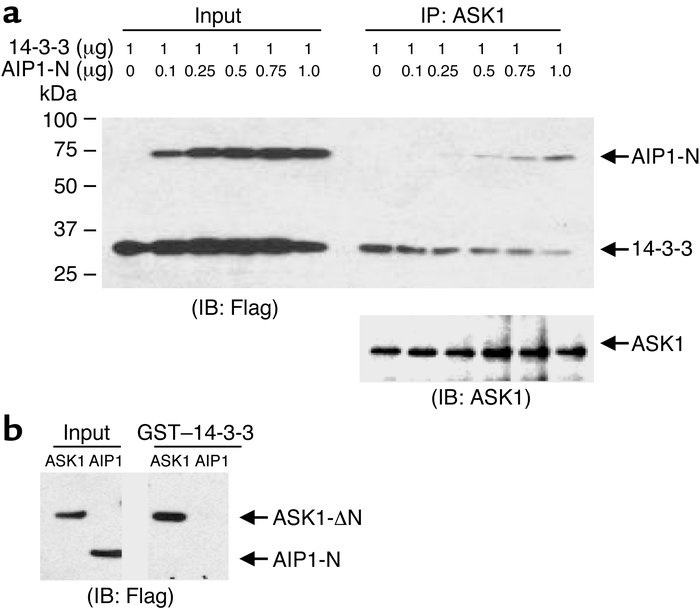 JCI - AIP1 mediates TNF-α–induced ASK1 activation by facilitating ...