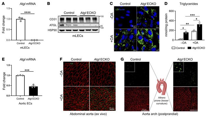 JCI - Dynamic metabolism of endothelial triglycerides protects against ...