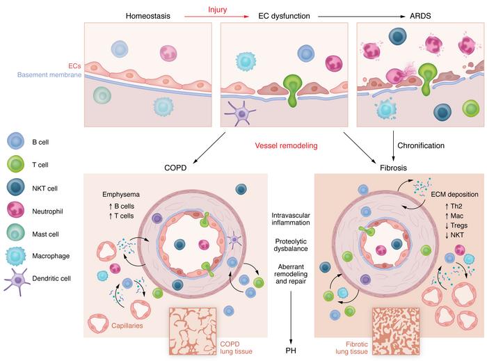 JCI - The vascular perspective on acute and chronic lung disease