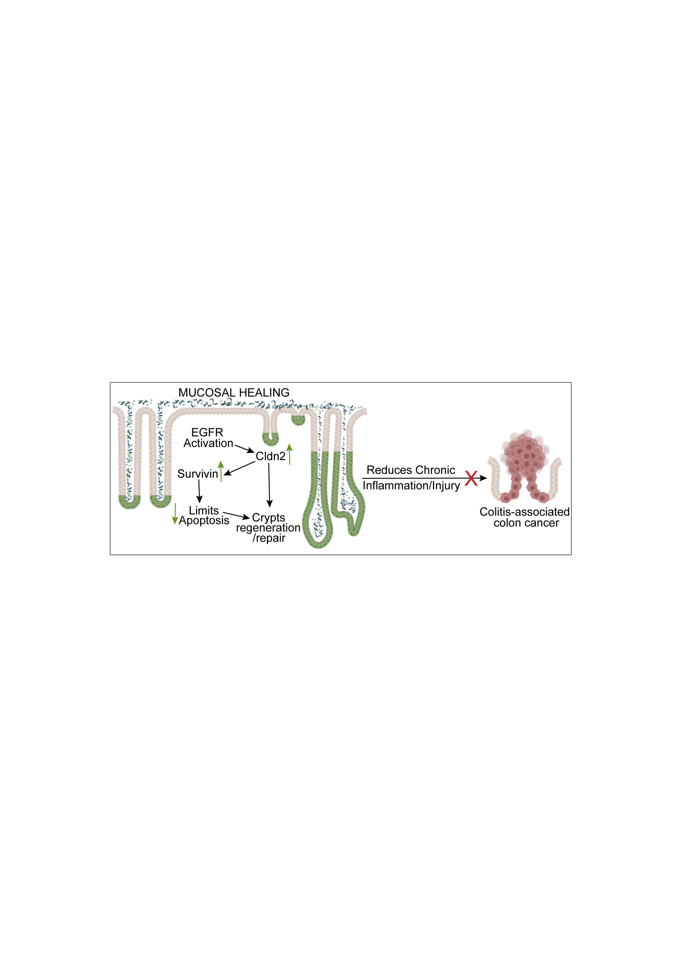 Claudin-2 Protects from Colitis-Associated Cancer by Promoting Colitis ...