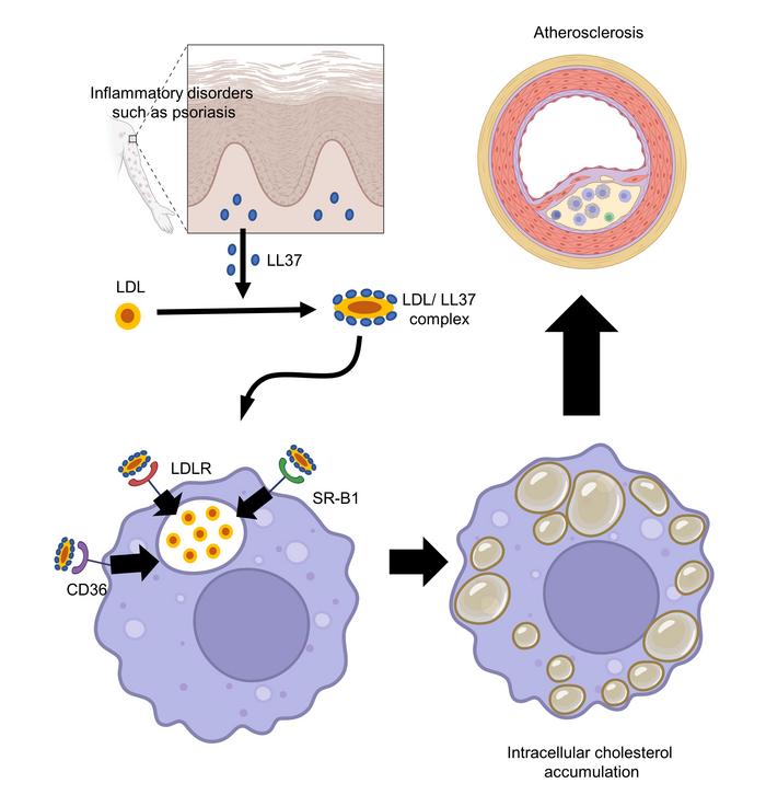 JCI - Increased LL37 in psoriasis and other inflammatory disorders ...