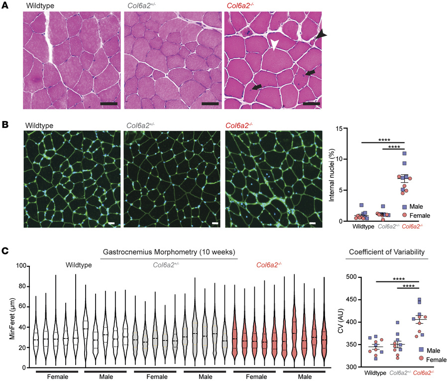 JCI - Collagen type VI regulates TGF-β bioavailability in skeletal ...