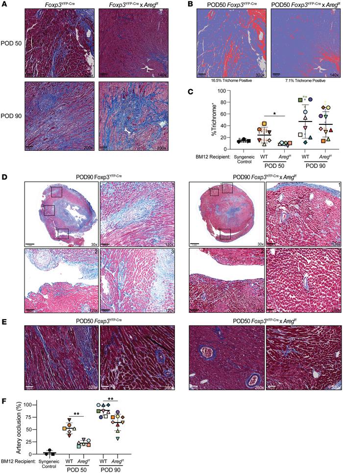 JCI - Dysregulated Treg repair responses lead to chronic rejection ...
