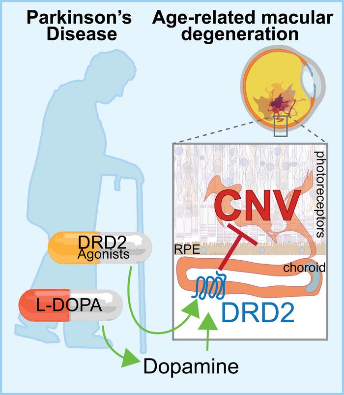 JCI - DRD2 activation inhibits choroidal neovascularization in patients with Parkinson’s disease ...