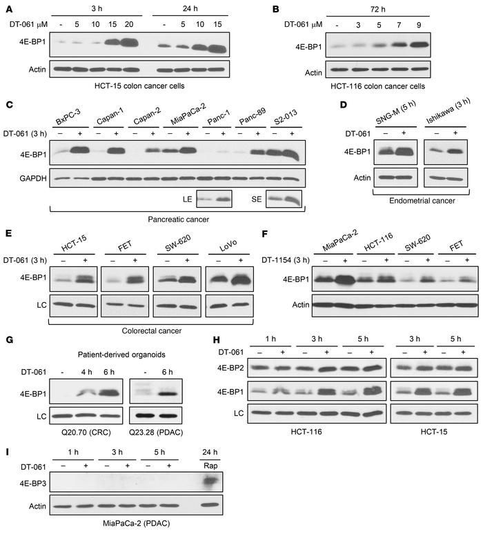 JCI - Small-molecule modulators of B56-PP2A restore 4E-BP function to ...