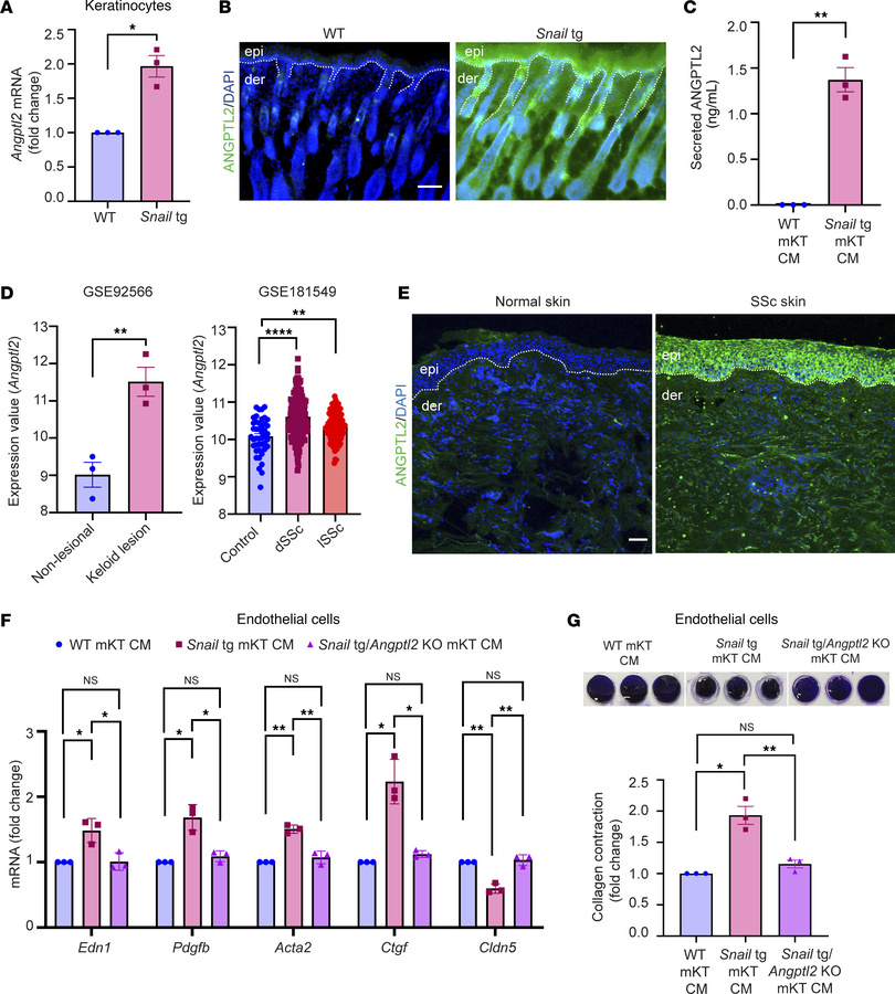 JCI - Angiopoietin-like protein 2 mediates vasculopathy-driven ...