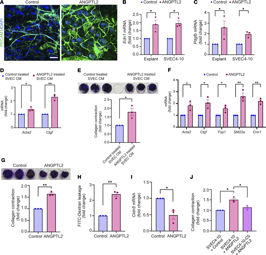 JCI - Angiopoietin-like protein 2 mediates vasculopathy-driven ...