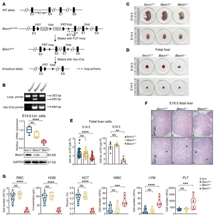 JCI - Beclin 1 prevents ISG15-mediated cytokine storms to secure fetal ...