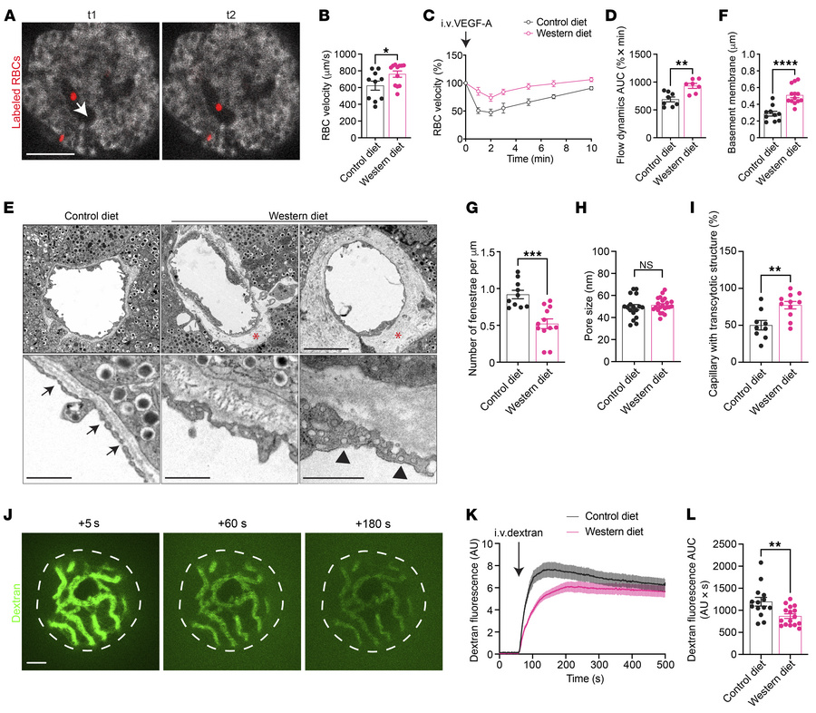 JCI - Diet-induced obesity promotes endothelial cell desensitization to ...
