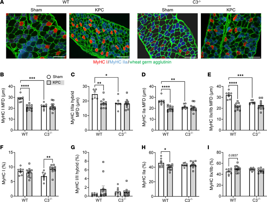 JCI - Complement pathway activation mediates pancreatic cancer–induced ...