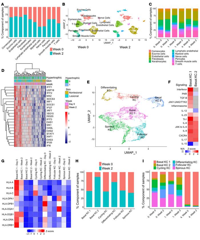 JCI - Rapid response of lichen planus to baricitinib associated with ...