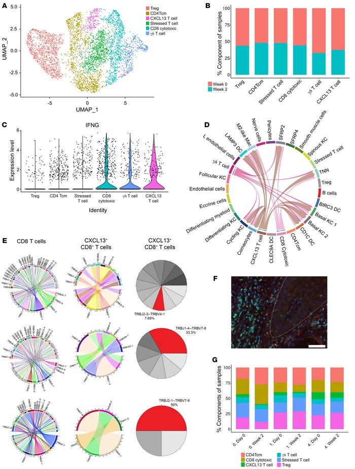 JCI - Rapid response of lichen planus to baricitinib associated with ...