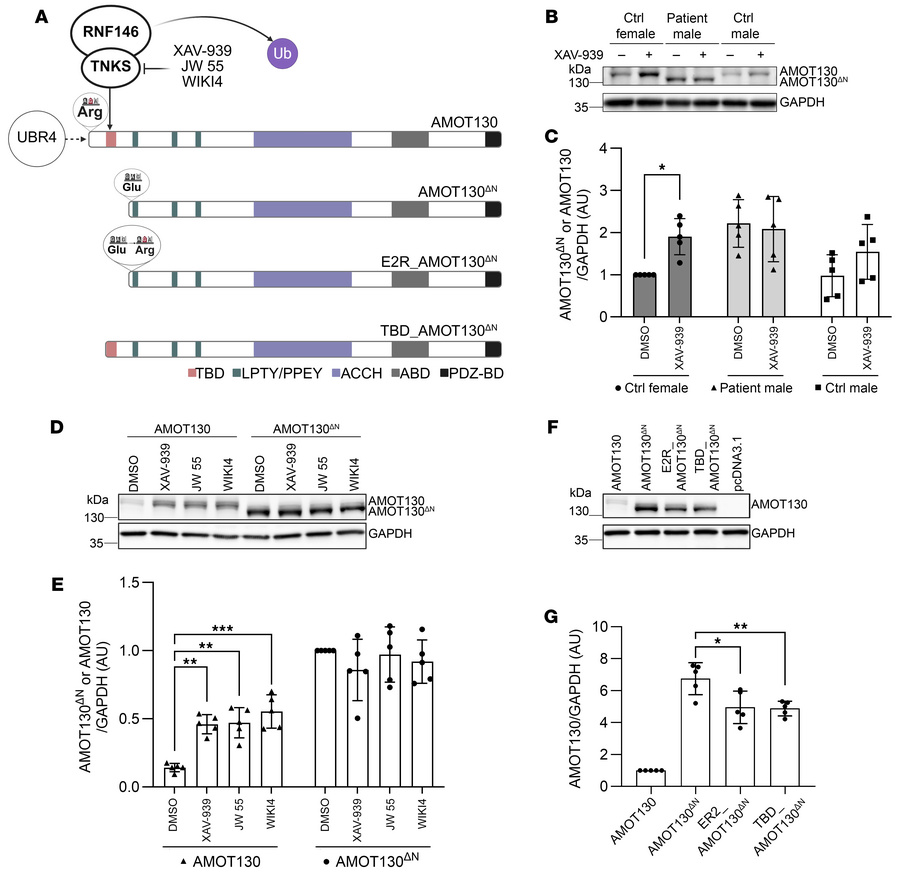 JCI - A pathogenic variant of AMOT leads to isolated X-linked ...