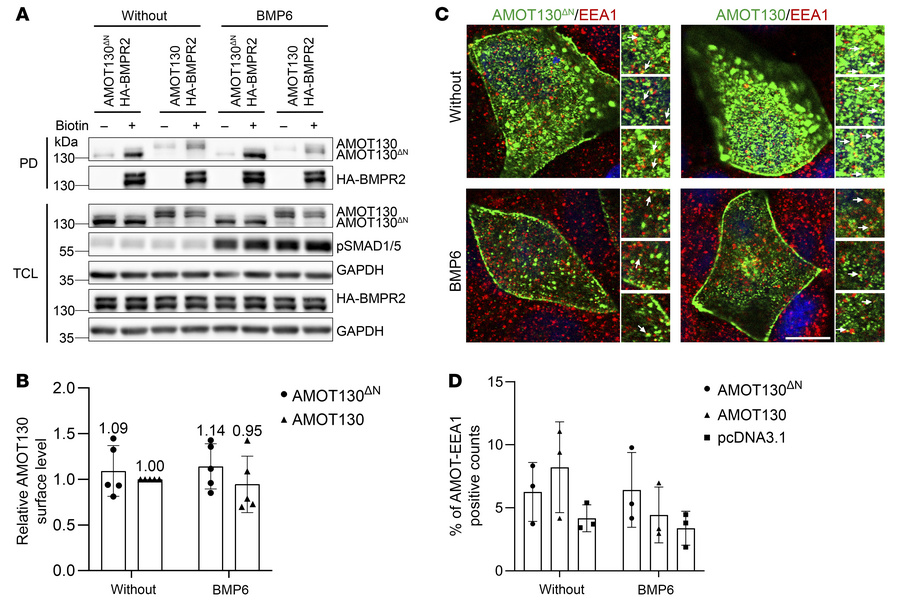 JCI - A pathogenic variant of AMOT leads to isolated X-linked ...