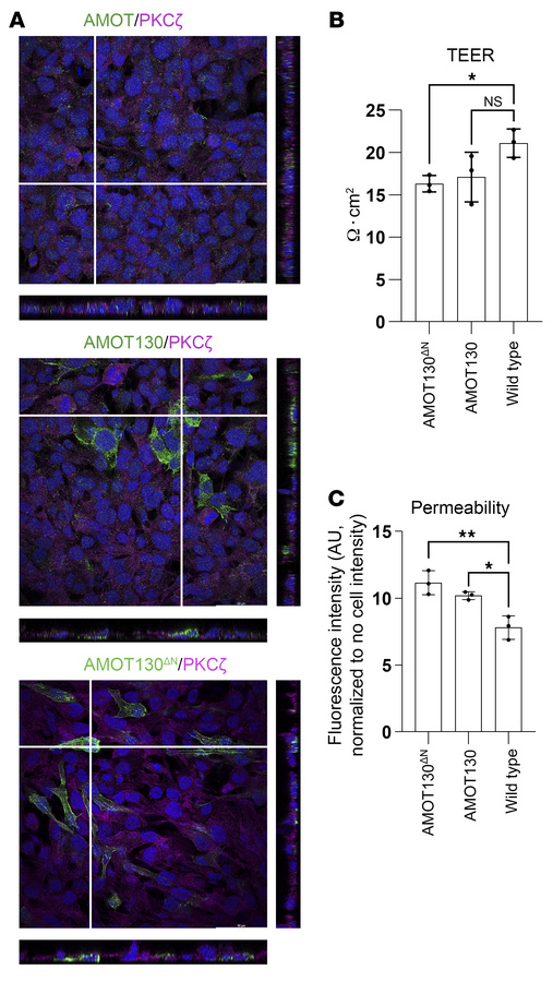 JCI - A pathogenic variant of AMOT leads to isolated X-linked ...