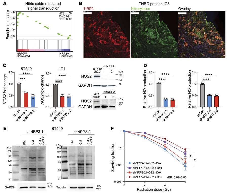 JCI - Neuropilin-2–expressing breast cancer cells mitigate radiation ...