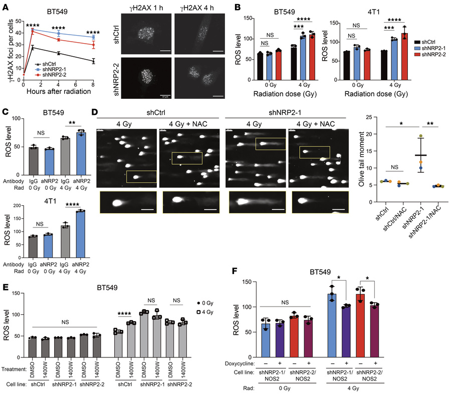 JCI - Neuropilin-2–expressing breast cancer cells mitigate radiation ...