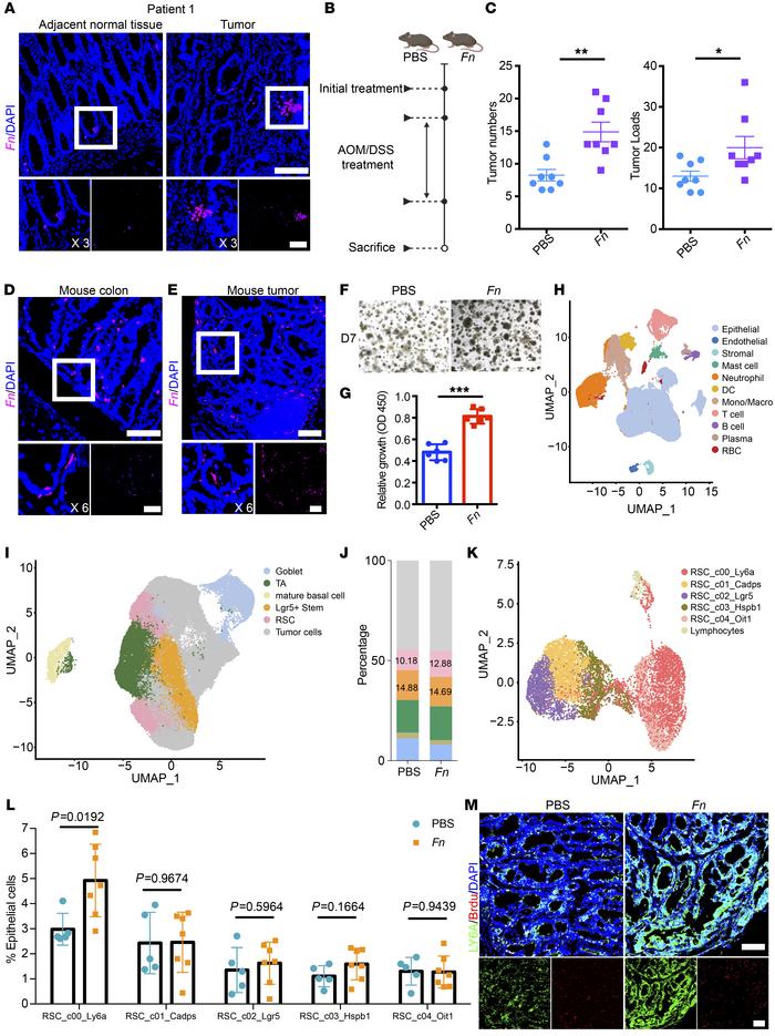 JCI - Fusobacterium nucleatum promotes colorectal cancer through ...