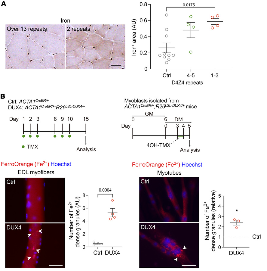 JCI - Iron supplementation alleviates pathologies in a mouse model of ...